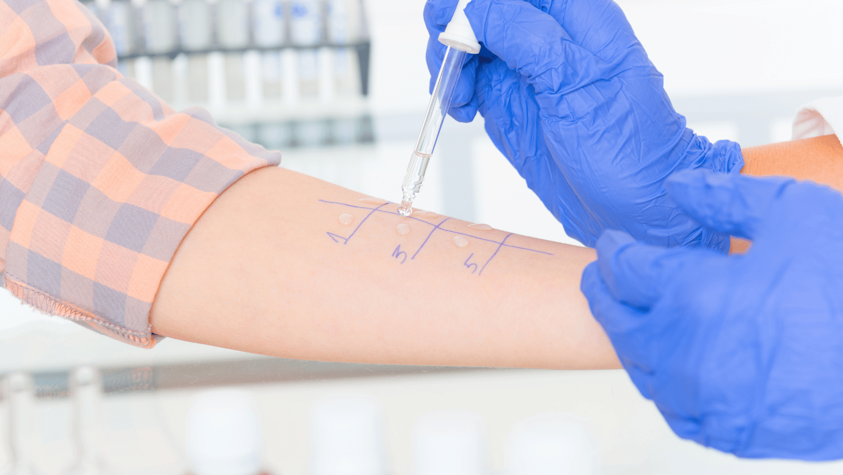 Alergia e Imunologia – Alergia Botafogo – Alergistas Rio de Janeiro